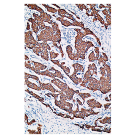 IHC (ImmunoHistoChemistry) - labex