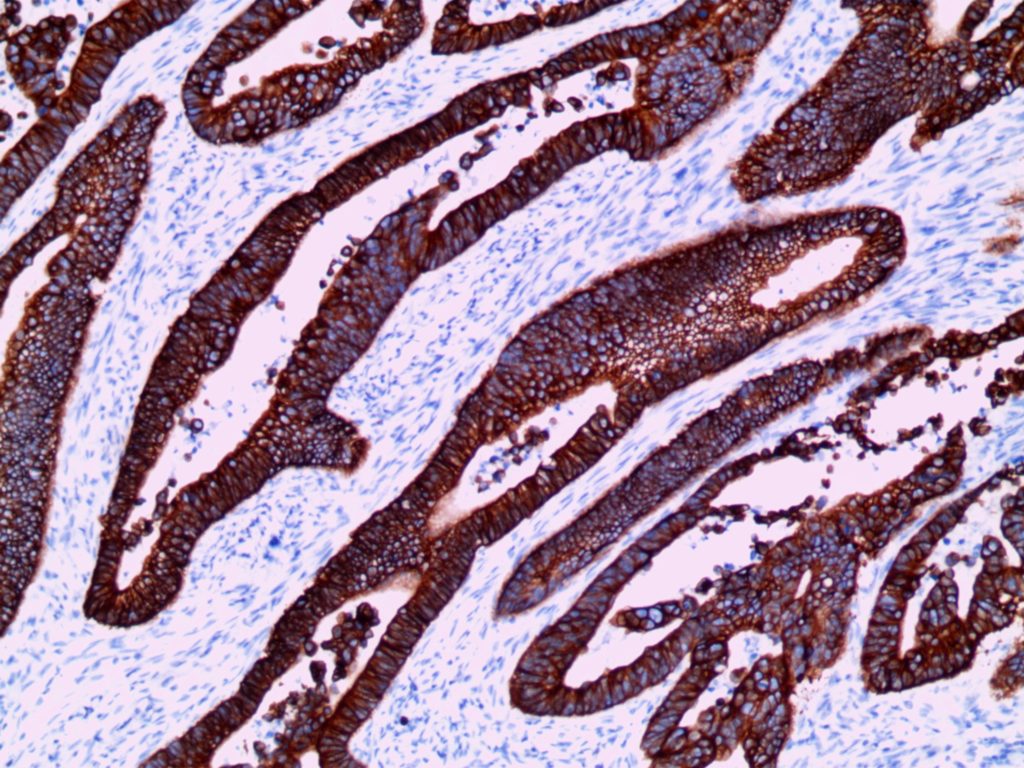 Cytokeratin20 (CK20) - labex