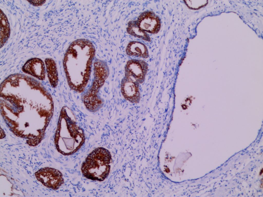 Prostate Specific Acid Phosphatase (PSAP) - labex