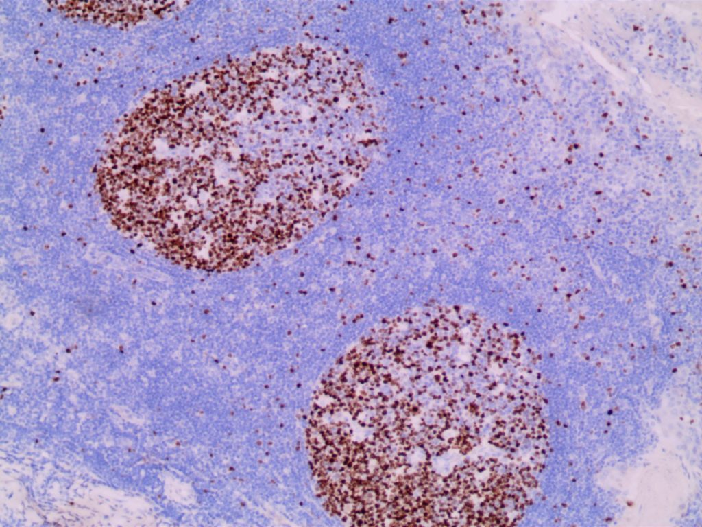 Topoisomerase II alpha (TOP2A) - labex