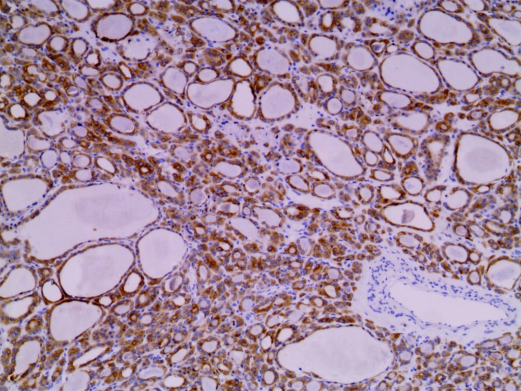 Thyroid Peroxidase (TPO) - labex