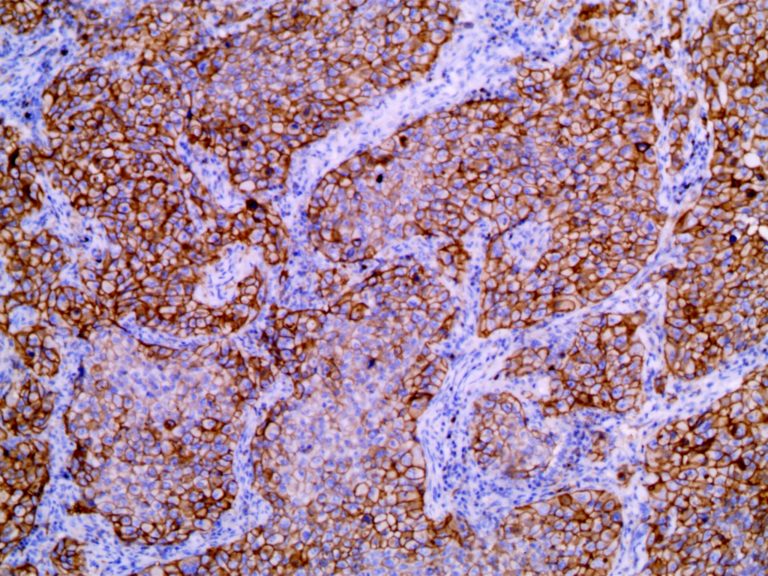 IHC (ImmunoHistoChemistry) - labex
